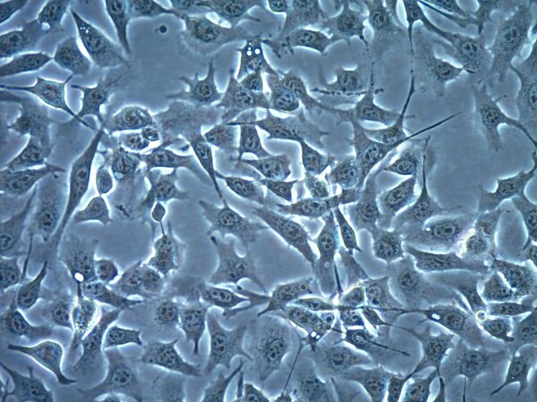B16-OVA MO4 Mouse Melanoma Cell Line | SCC420